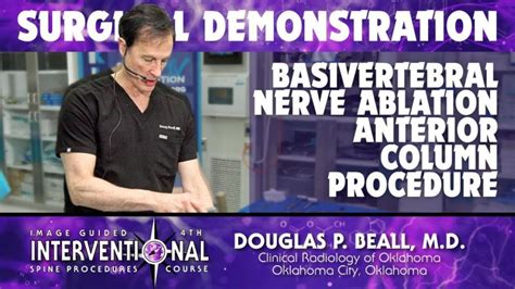 Basivertebral Nerve Ablation Anterior Column Procedure Douglas Beall Md Douglas Beall