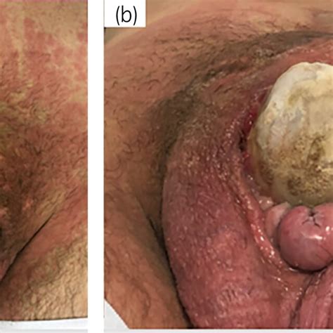 Calculus Examination Ad Calculus Measurement Download Scientific