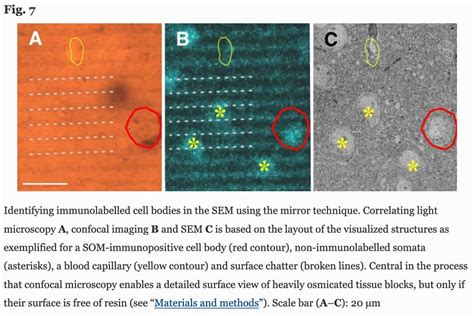 correlating immunohistochemistry with serial block face electron