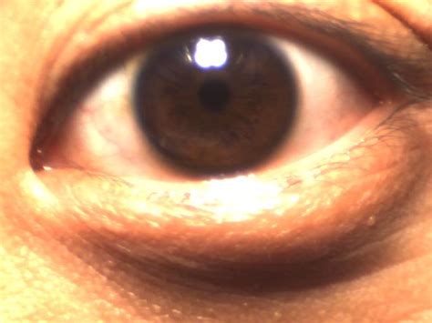 Irissegmentation Irissegmentation Tocli Roboflow Universe