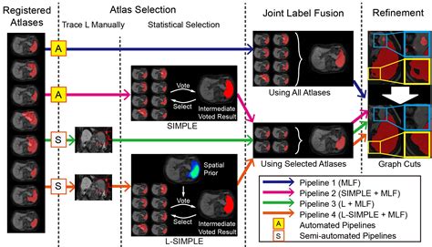 Robust Multi Contrast Mri Spleen Segmentation For Splenomegaly Using Multi Atlas Segmentation