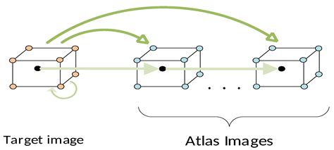 Dense Multi Scale Graph Convolutional Network For Knee Joint Cartilage