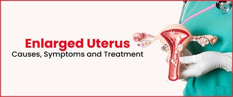 Enlarged Uterus Causes Symptoms And Treatment Uterine Fibroids