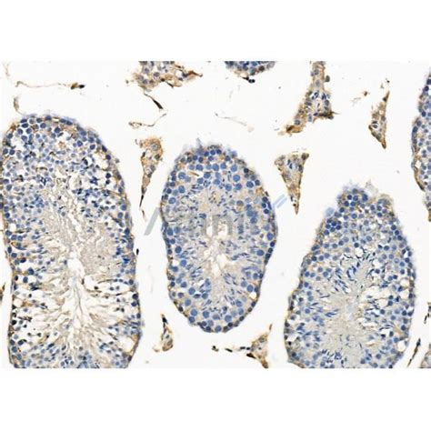 Vimentin Mouse Monoclonal Antibody Affinity Biosciences