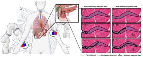 Innovative Magnetic Robotic Catheters A Step Forward In Minimally