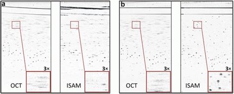 Interferometric Synthetic Aperture Microscopy Isam Ento Key