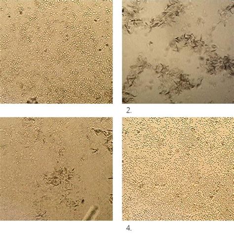 Cell Composition Of Vaginal Smears Read At Different Stages Of Estrus