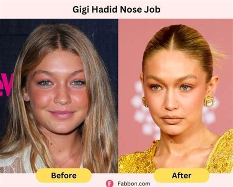 51 Most Popular Celebrity Nose Jobs Before And After With Images Fabbon