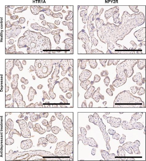 Immunohistochemically Stained Placental Tissue From Representative