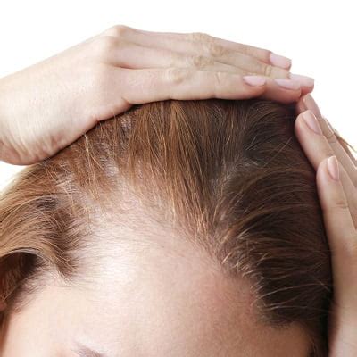 3 Things You Didnt Know Were Making Women Go Bald Skn Clinic