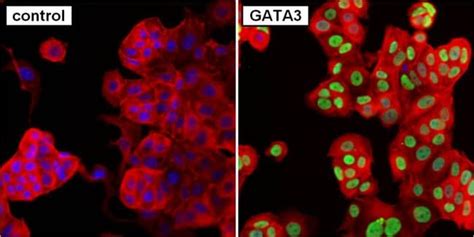 Gata3 Antibody Ma1 028