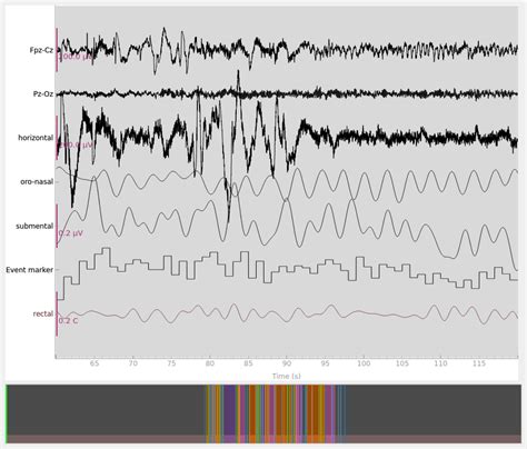 Sleep Stage Classification From Polysomnography Psg Data — Mne 1101 Documentation