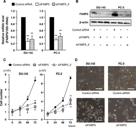 Fabp5 Knockdown Significantly Suppresses Cell Growth In Pca Cells A