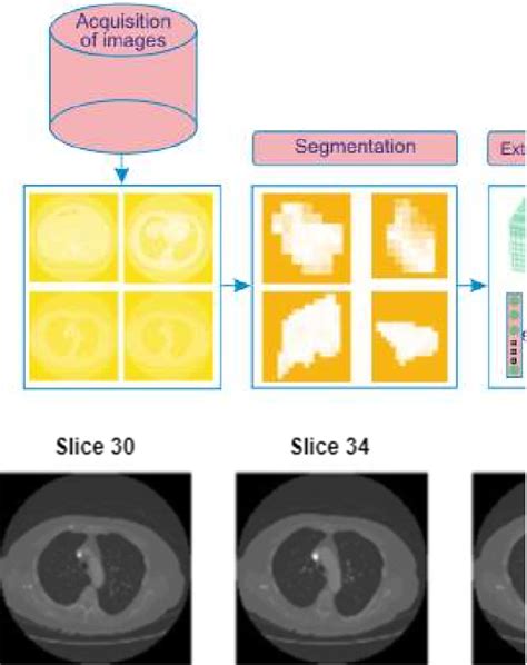 Figure 2 From Innovative Method Of Classification Of Pulmonary Nodules Using 3d Cnn Architecture