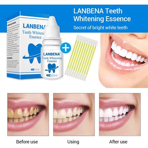 Teeth Whitening Antibiotic Staining