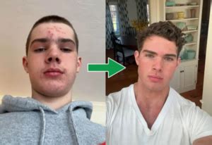‘looksmaxxing Influencer Clavicular Walks Out Of 60 Minutes