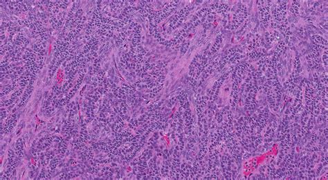 Granulosa Cells