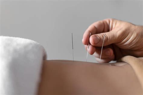 Dry Needling Vs Acupuncture Which Is Better Cross Up Chiropractic