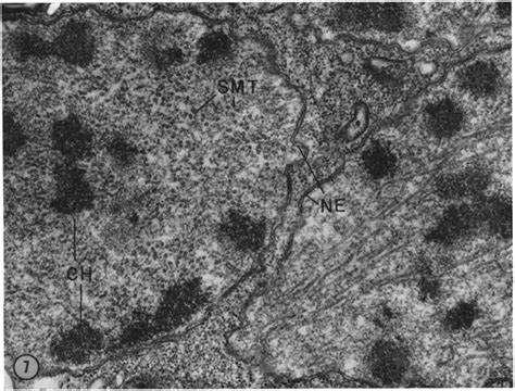 Portions Of Three Dividing Micronuclei Are Included In This Download Scientific Diagram