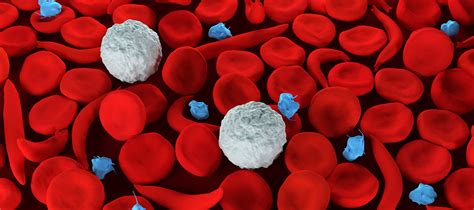 Sickle Cell Disease Johns Hopkins Medicine