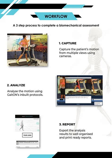 Camera Based Gait Analyzer System For Clinical At Best Price In New Delhi