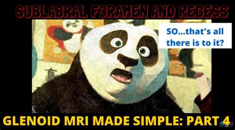 Glenoid Labrum Mri Simplified 4 Sublabral Foramen And Recess Radedasia