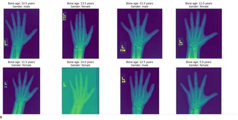 himanshu mourya on linkedin deeplearning ai machinelearning transferlearning medicalimaging…