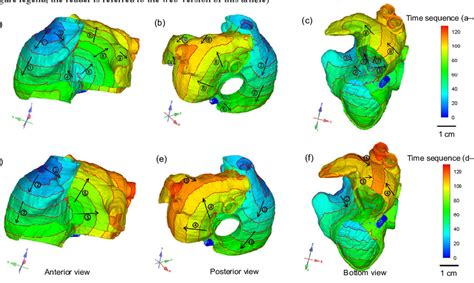 Conduction Pattern Via Bb Without Fast Bundles Ac Are The Excitation