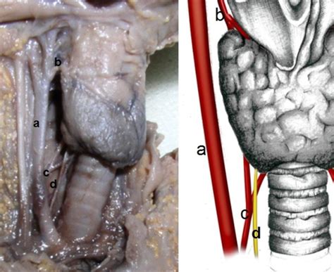 Inferior Thyroid Artery Cadaver