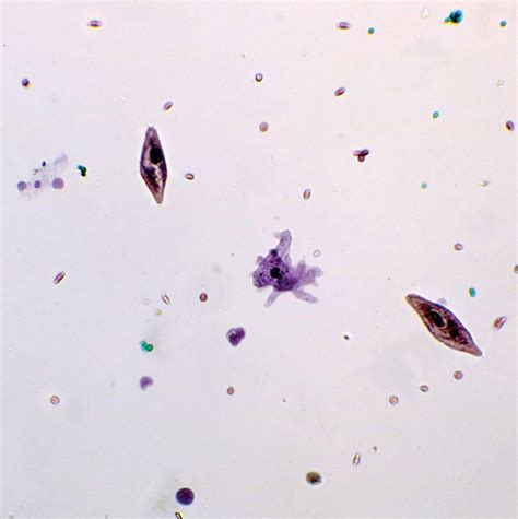 Protozoan Microscope Slide Set