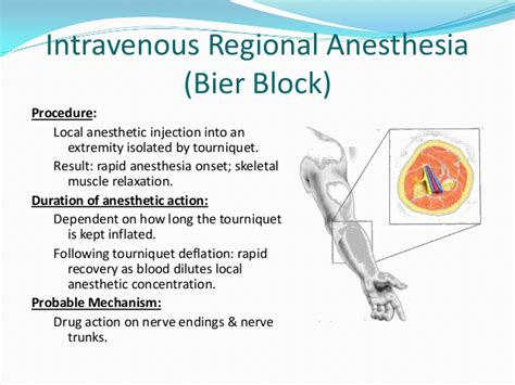 Bier Block What To Know