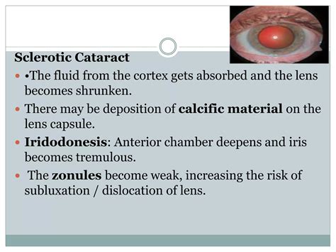 Cataract Pptpptx