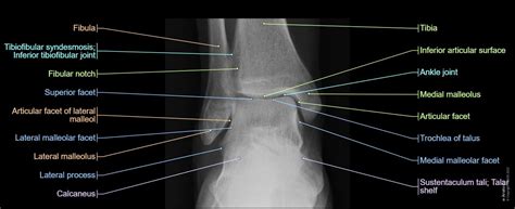 Radiological Anatomy Of The Lower Limb E Anatomy