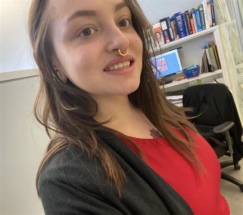 Braces Were Taken Off Today After 15 Months The First 5 Months With An Expander And The Last