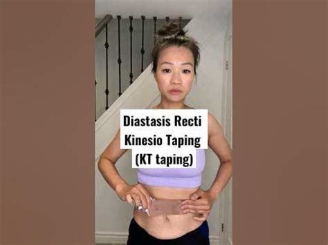 Diastasis Recti Kt Taping Kinesio Taping Kttape Youtube