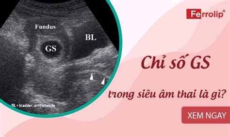 Chỉ Số Gs Trong Siêu âm Thai Là Gì Ý Nghĩa Chỉ Số Trong Siêu âm