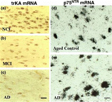 Validation Of Cdna Array Results Using In Situ Hybridization Download Scientific Diagram