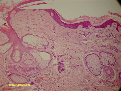 Scalp Histology Diagram Quizlet