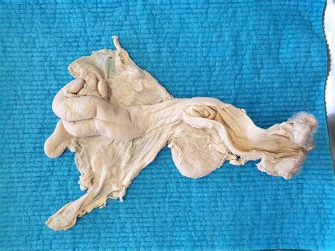 Diagram Of Diagram Of Ewe Reproductive Tract Week 10 Quizlet