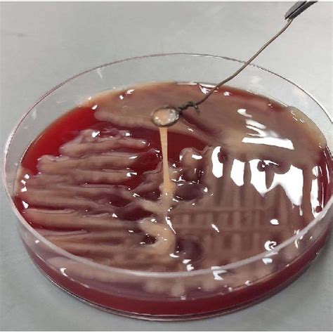 Representative Image String Test Strings 5mm Indicates The