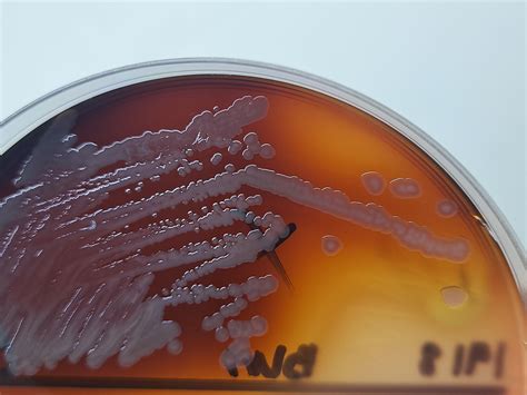 Pyomelanin Production In Pseudomonas Aeruginosa R Microbiology
