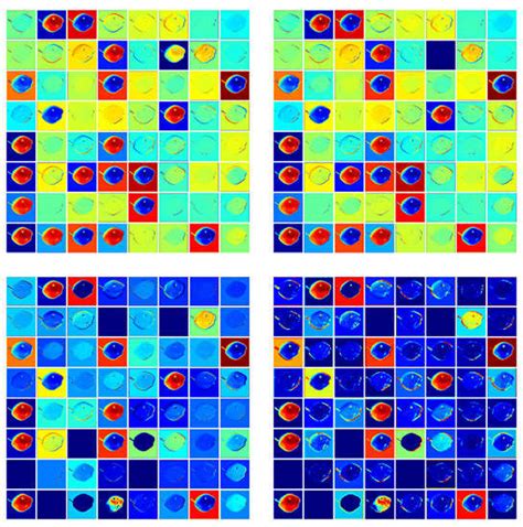 Pear Defect Detection Method Based On Resnet And Dcgan