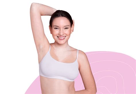 Hiperhidrosis Clinicas Ede