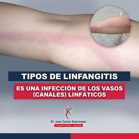 🔴 Hay Dr Juan Carlos Sotomayor Cirujano Cardiovascular