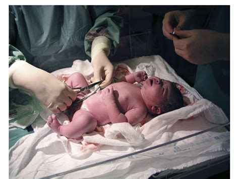 Организация обслуживания новорожденных в родильном доме презентация онлайн