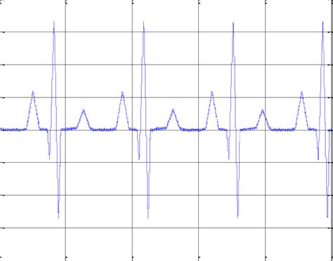 Abdominal Ecg Signal Download Scientific Diagram