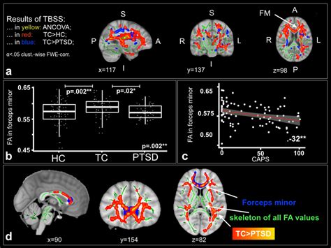 results of diffusion tensor imaging download scientific diagram