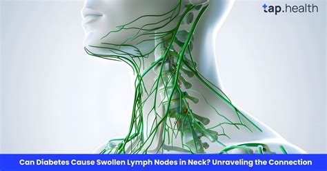 Can Diabetes Cause Swollen Lymph Nodes In Neck Unraveling The