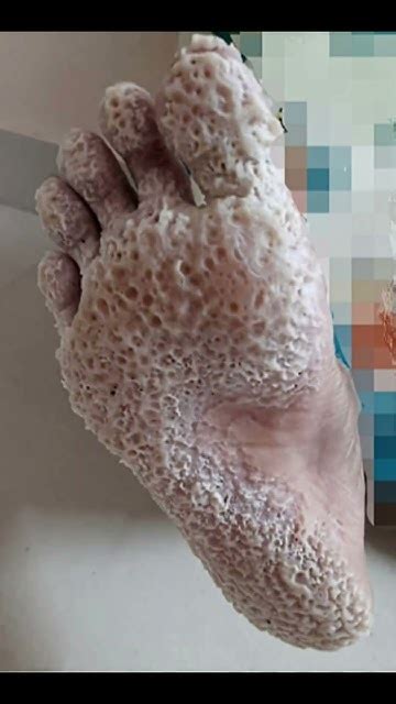 Do You Have Trypohobia Trypophobia Horrorshorts Thriller Creepy