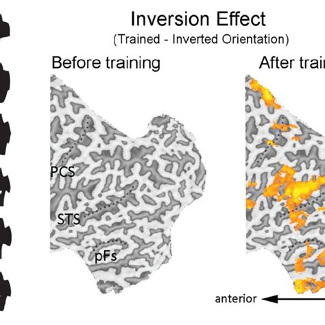 Left An Example Subjects Right Fusiform Face Area Ffa And Right
